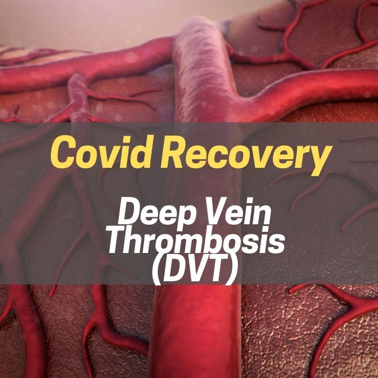 Covid Recovery – Deep Vein Thrombosis (DVT)